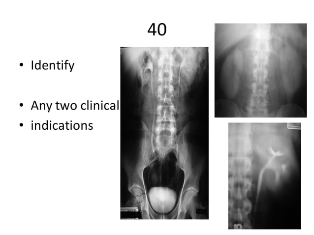 Contrast and special radiographic procedures New (1).pdf