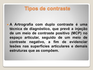 Estudo das articulações - Exames contrastados | PPTX