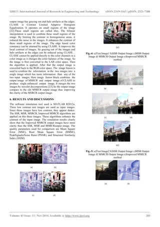 Contrast enhancement of color images using improved retinex method | PDF