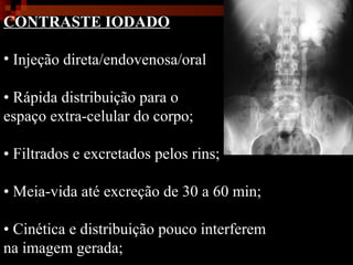 Contraste radiologico | PPT