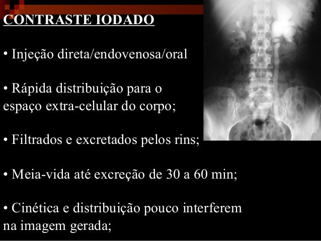 Contraste radiologico