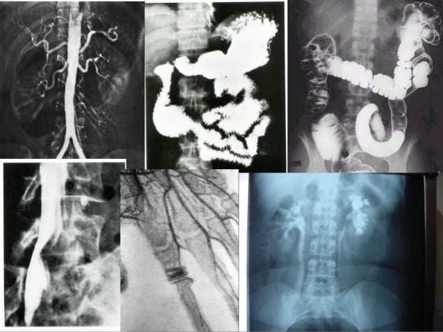 Contraste radiologico
