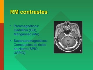 Contrastes y seguridad en MRI | PPT
