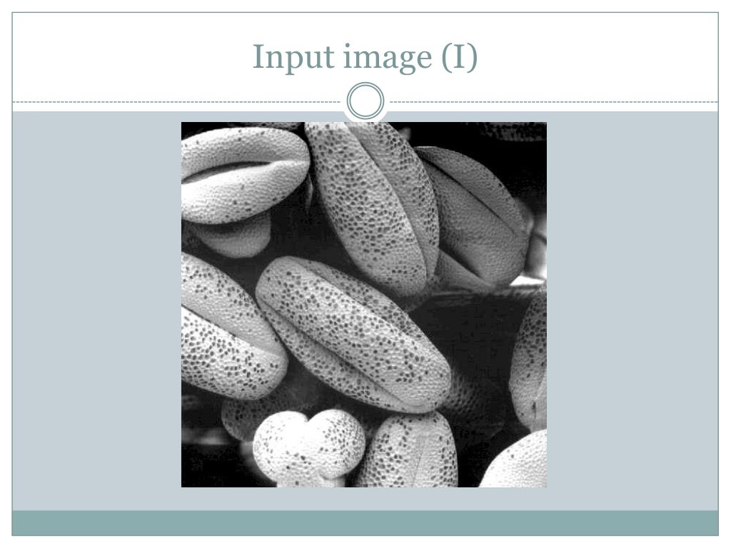 Contrast Limited Adaptive Histogram Equalization contrast-limited-adaptive-histogram-equalization