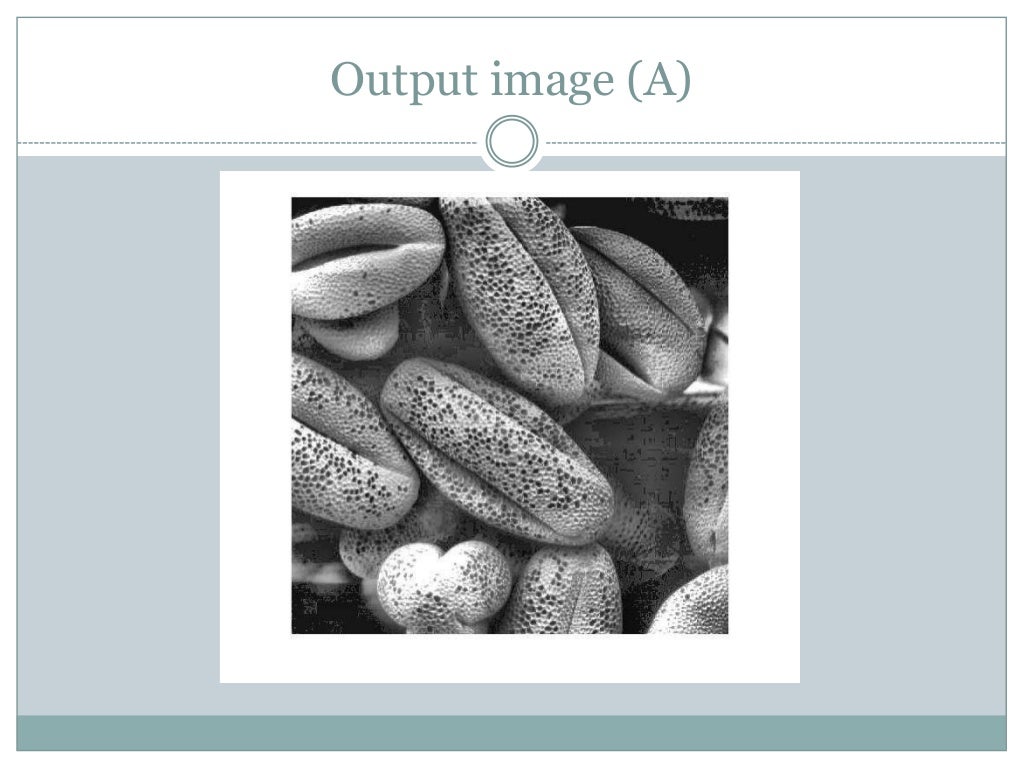 Contrast Limited Adaptive Histogram Equalization Contrast Limited Adaptive Histogram Equalization