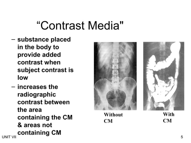Contrast media | PPT | Chemistry | Science