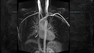 Contrast media in radiology | PPTX