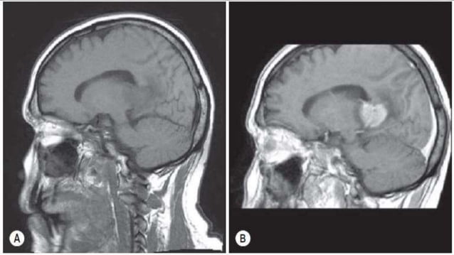 Contrast media in radiology | PPTX | Chemistry | Science