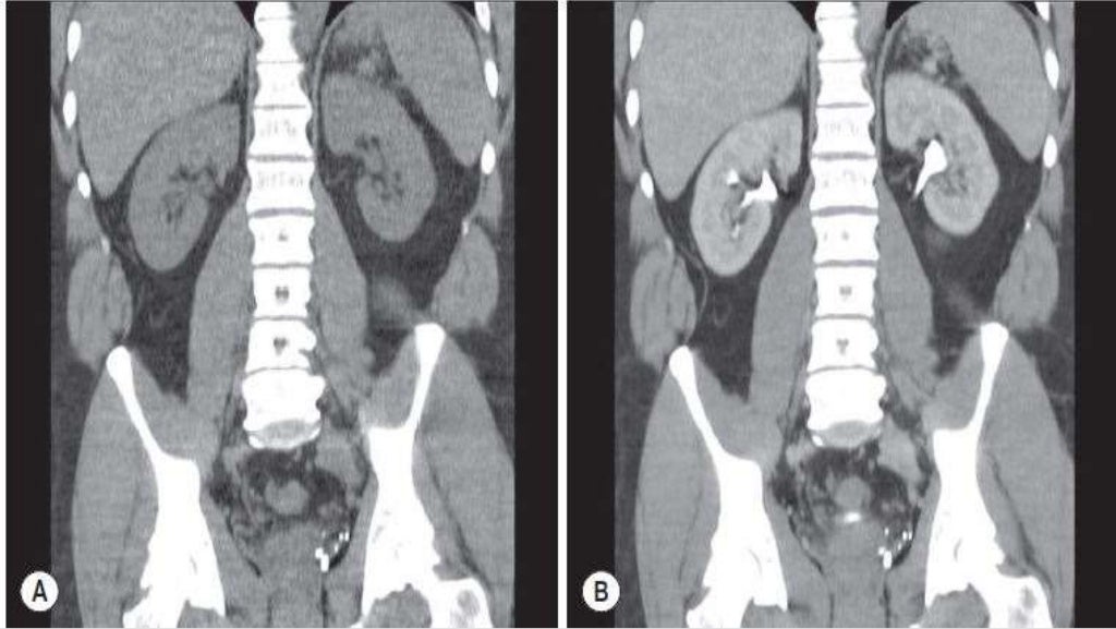 Contrast media in radiology