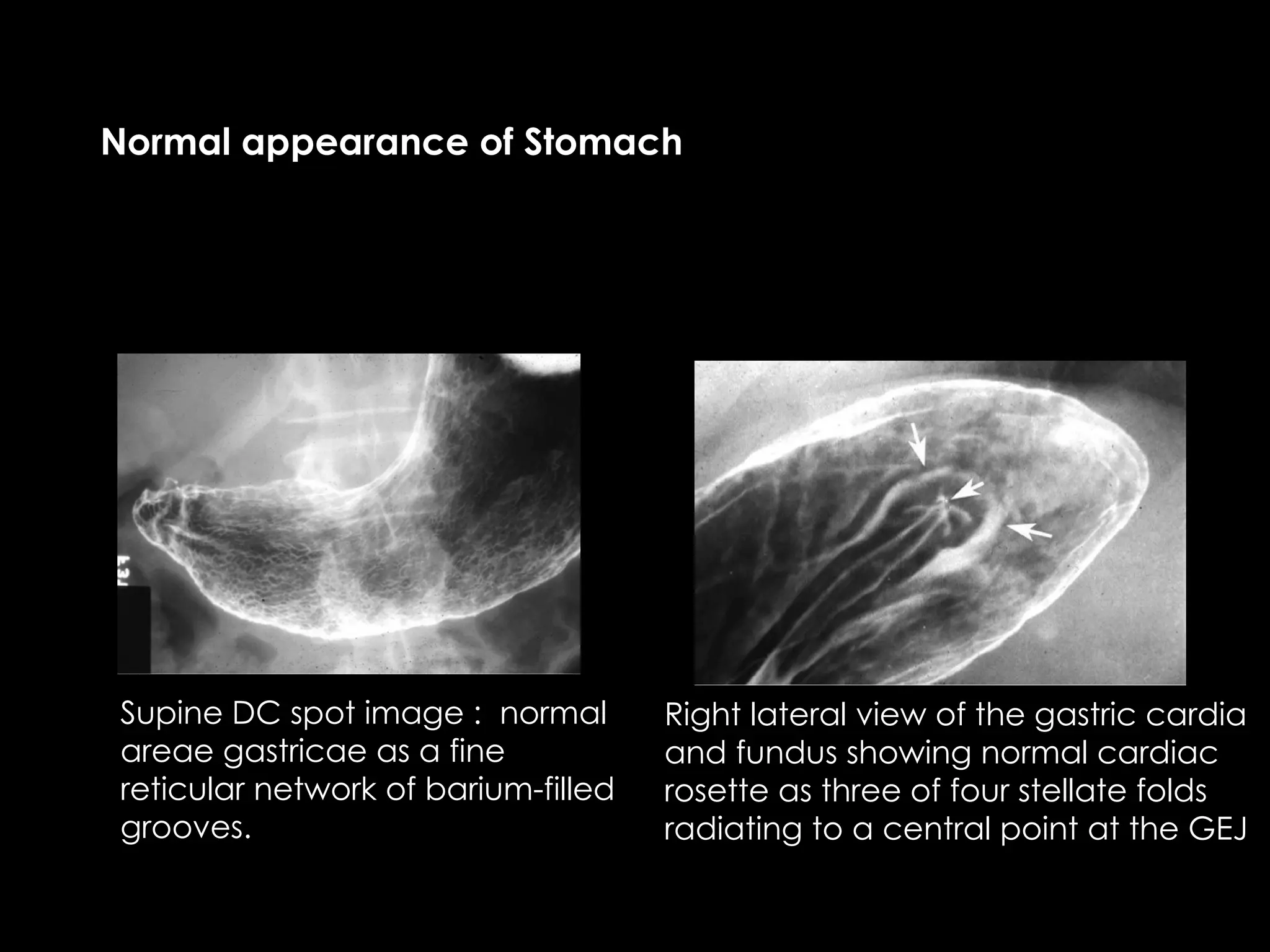 CONTRAST MEDIA usg, xray ct and mri.. presentation | PPT