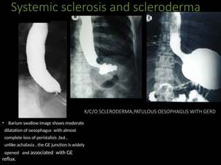CONTRAST MEDIA usg, xray ct and mri.. presentation | PPT