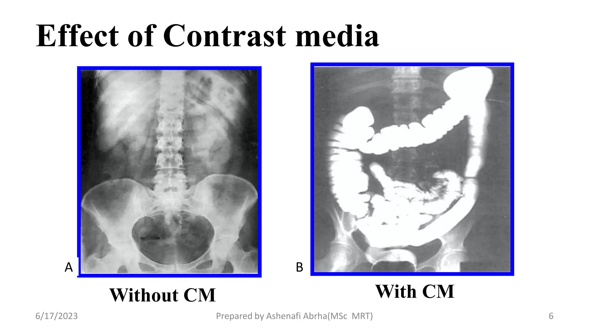 contrast media(1).pptx