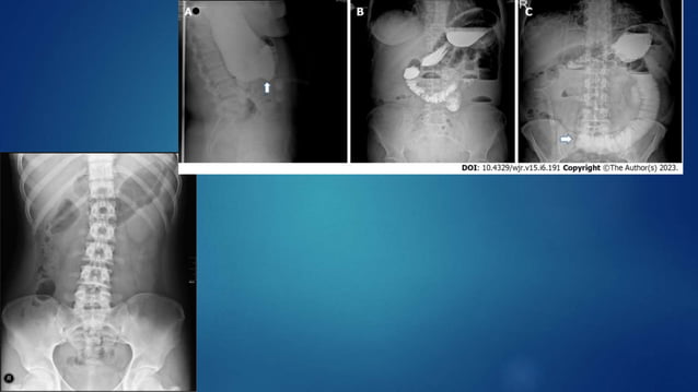 CONTRAST MEDIA in diagnostic radiography | PPTX