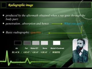 Contrast media 1 | PPT