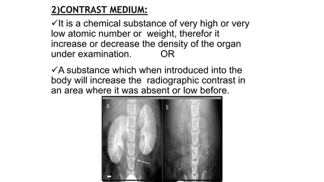 Contrast media and drugs radiology pk | PPTX | Medical Tests | Medical ...