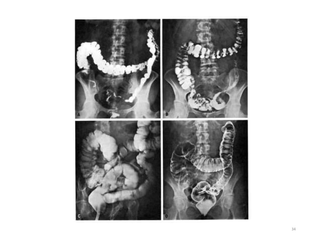 Radiology Contrast media and its Types | PPTX