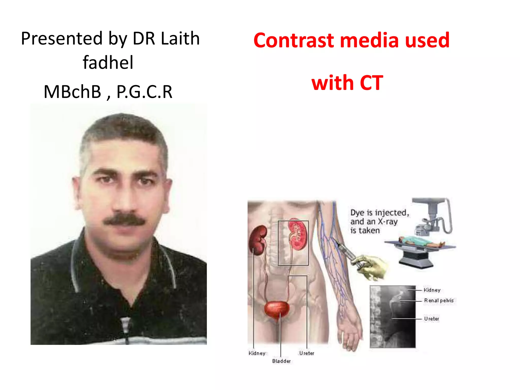 Contrast media used with ct | PPTX