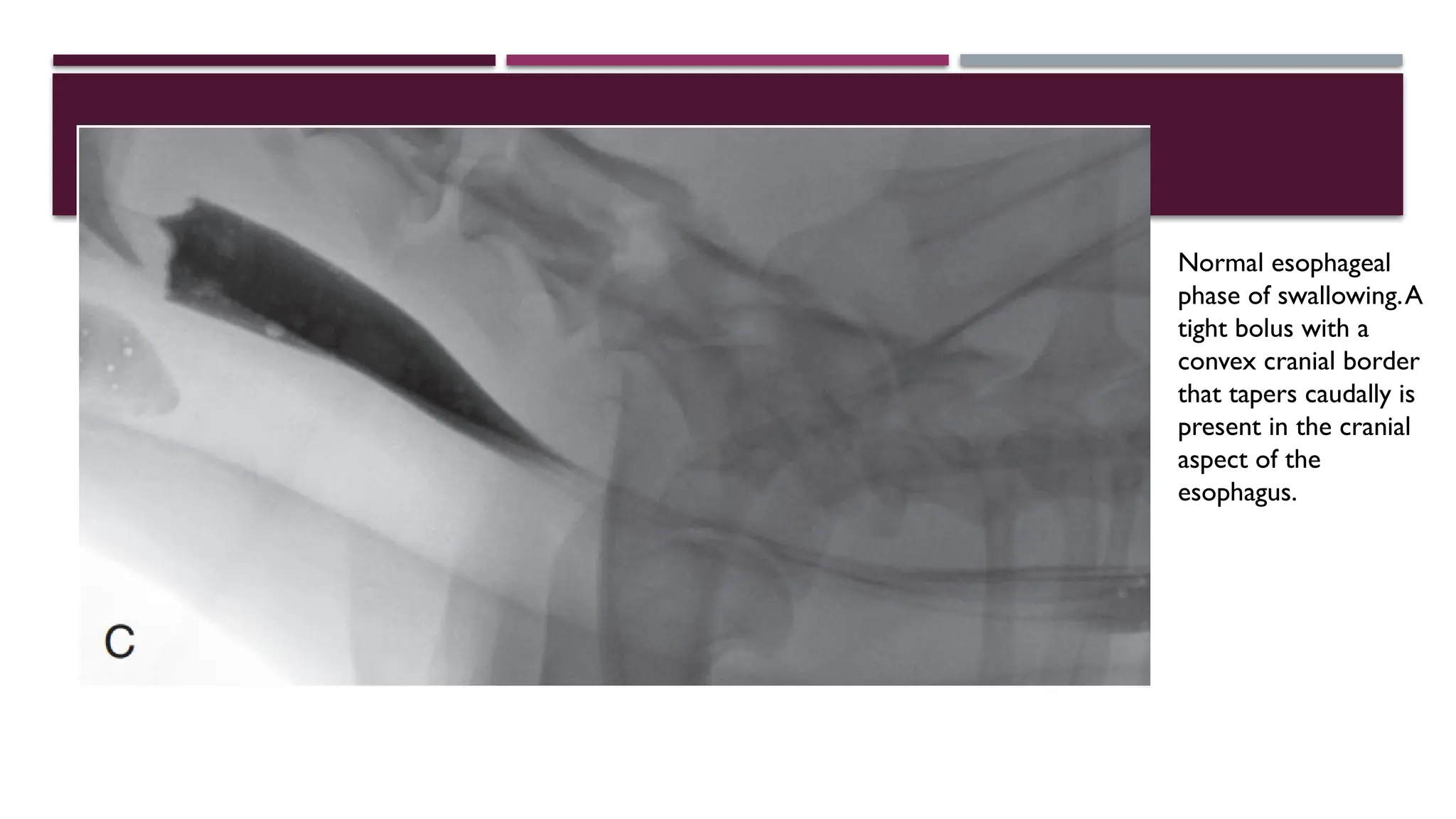 contrast radiography - diagnostic imaging.pptx
