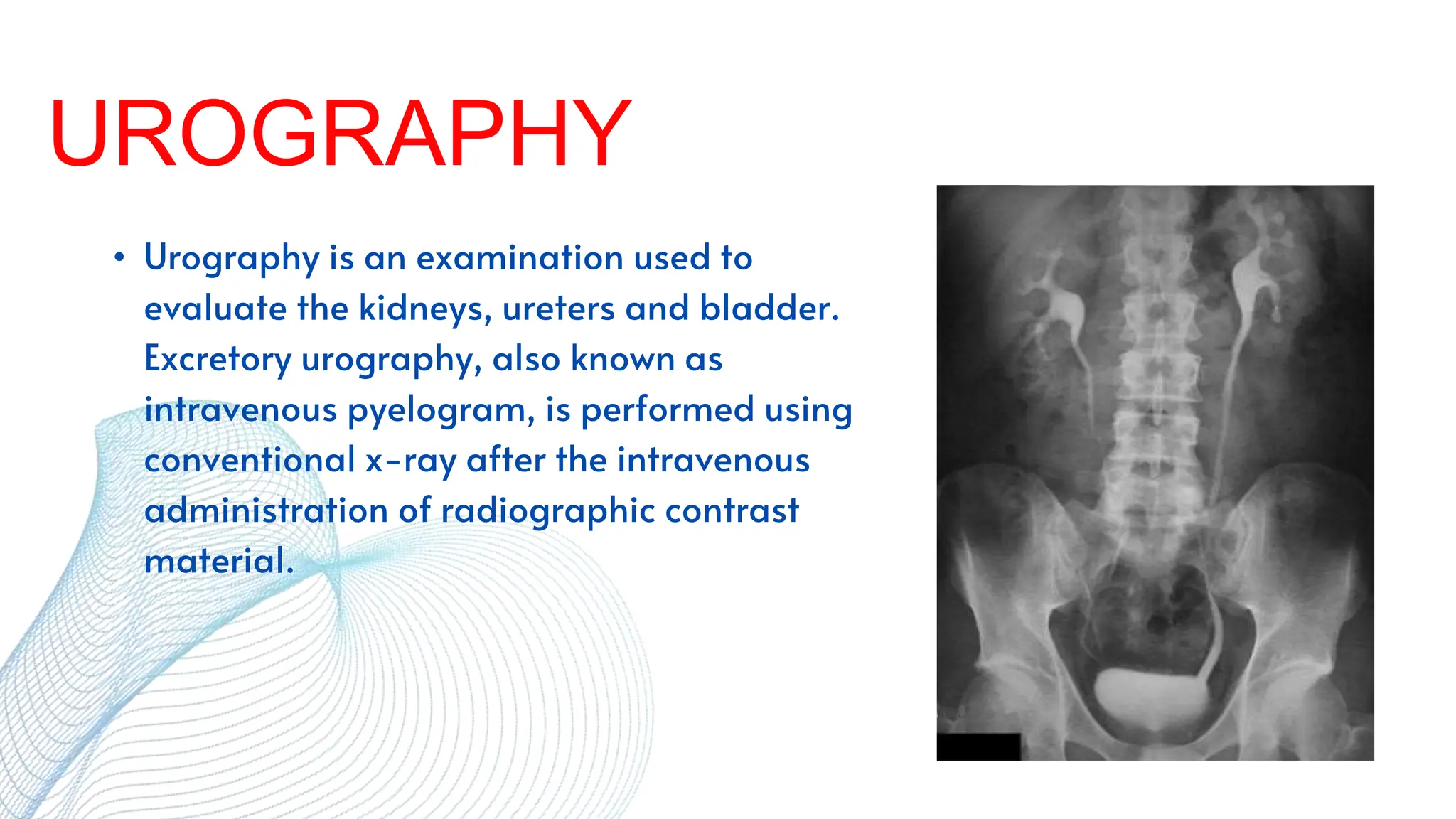 Contrast Radiography, Radioisotopes , Scintigraphy | PPTX