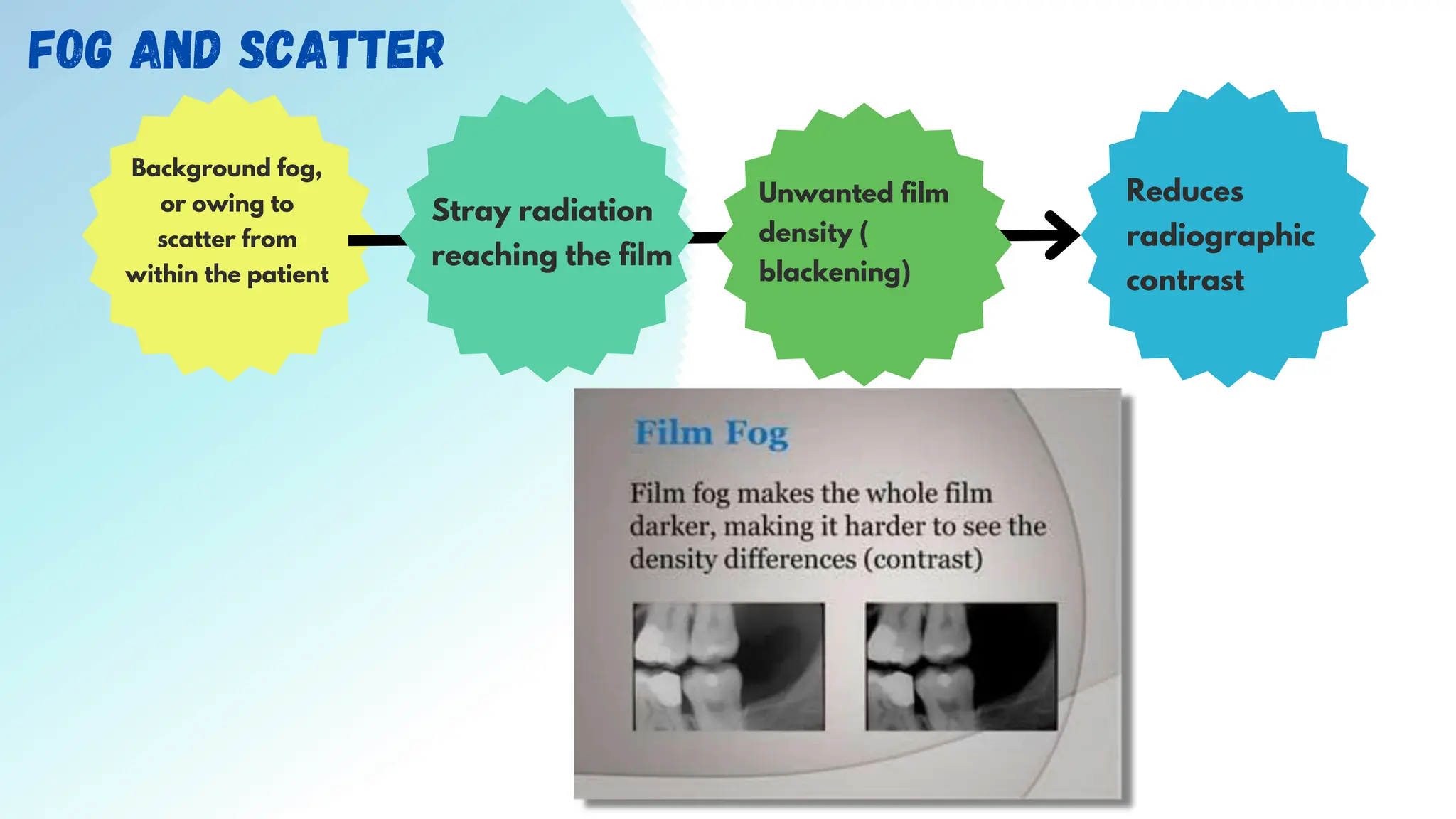 Contrast Radiography, Radioisotopes , Scintigraphy | PPTX
