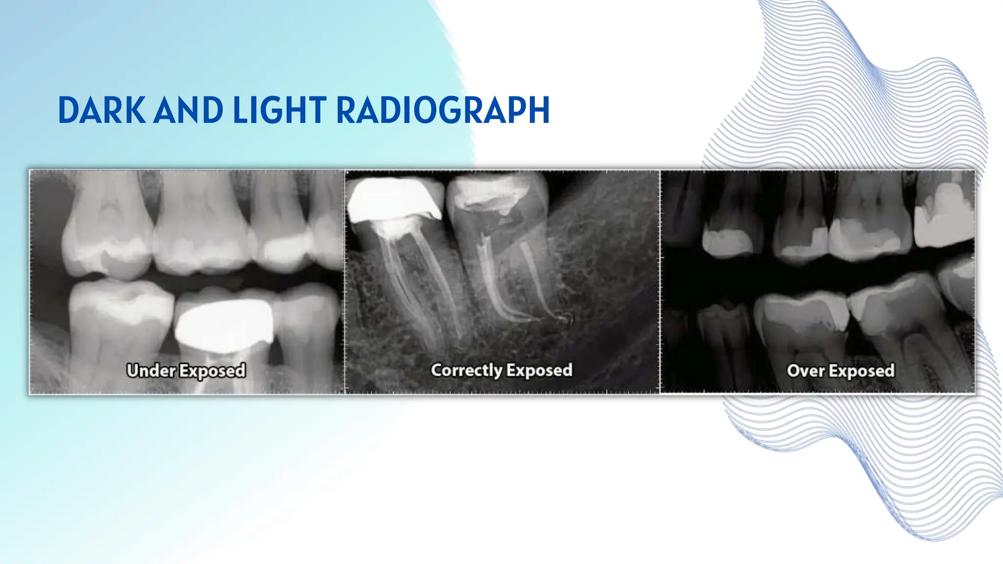 Contrast Radiography, Radioisotopes , Scintigraphy | PPTX