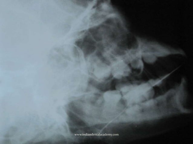 Contrast radiography / dental implant courses | PPTX