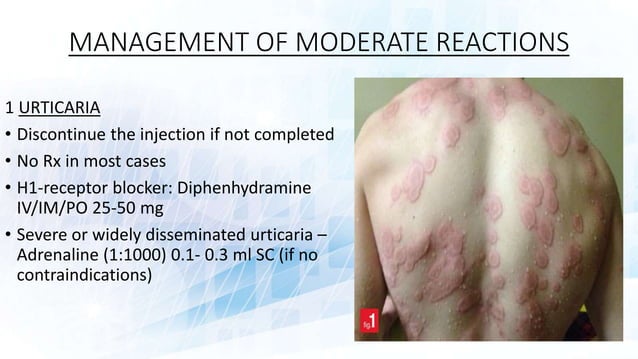 Contrast reactions and its management | PPTX | Allergies | Diseases and ...