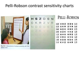 Contrast sensitivity | PPTX