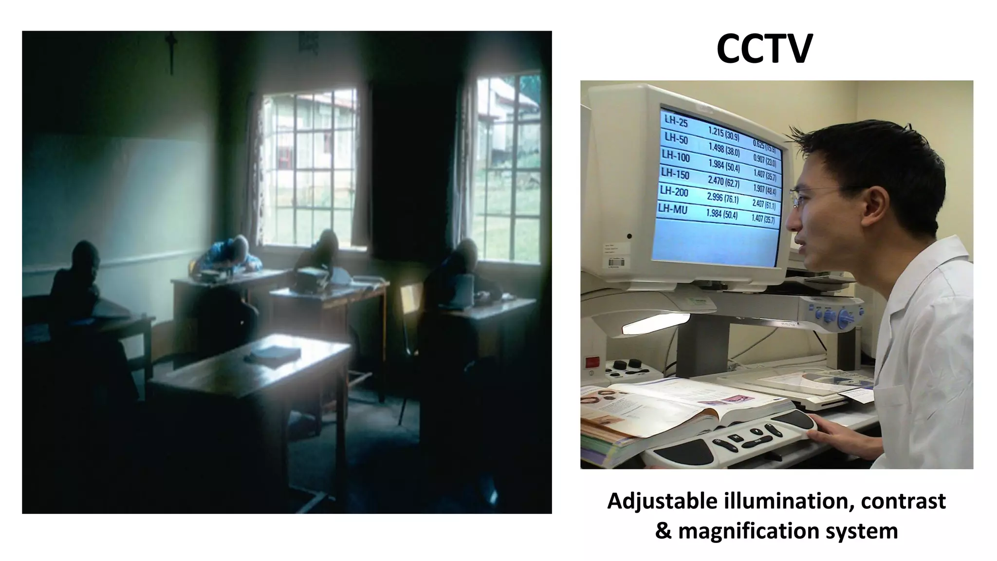 Contrast sensitivity, Clinical assessment of intra-ocular light scatter ...