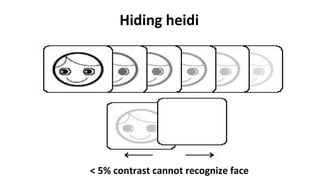 Contrast sensitivity, Clinical assessment of intra-ocular light scatter ...