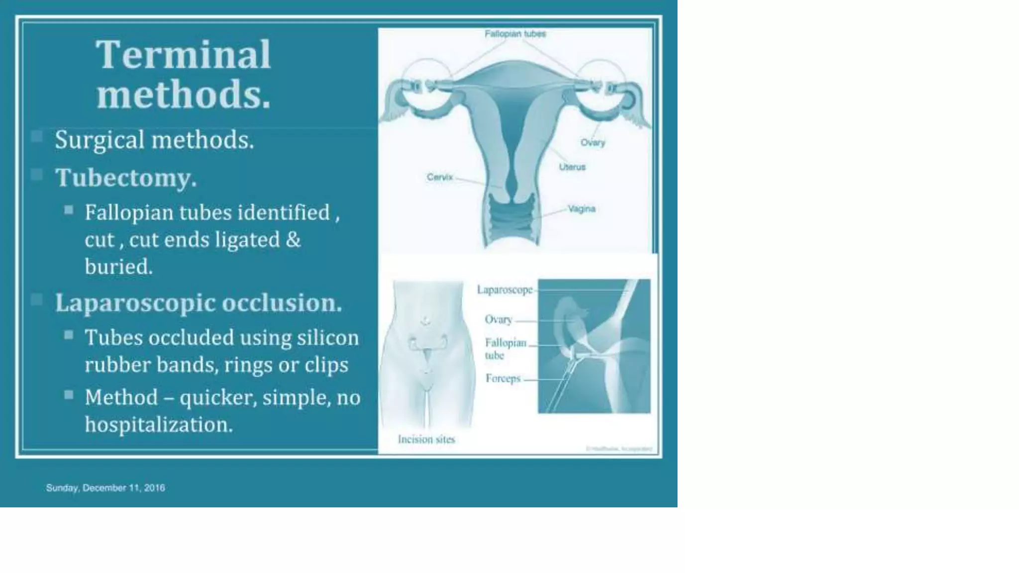 Contrceptive Methods.pptx