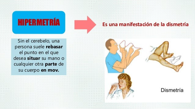 Contribuciones del cerebelo y los ganglios basales al control motor g…