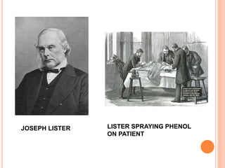 Contributions of Edward jenner, Robert koch and Joseph Lister | PPTX