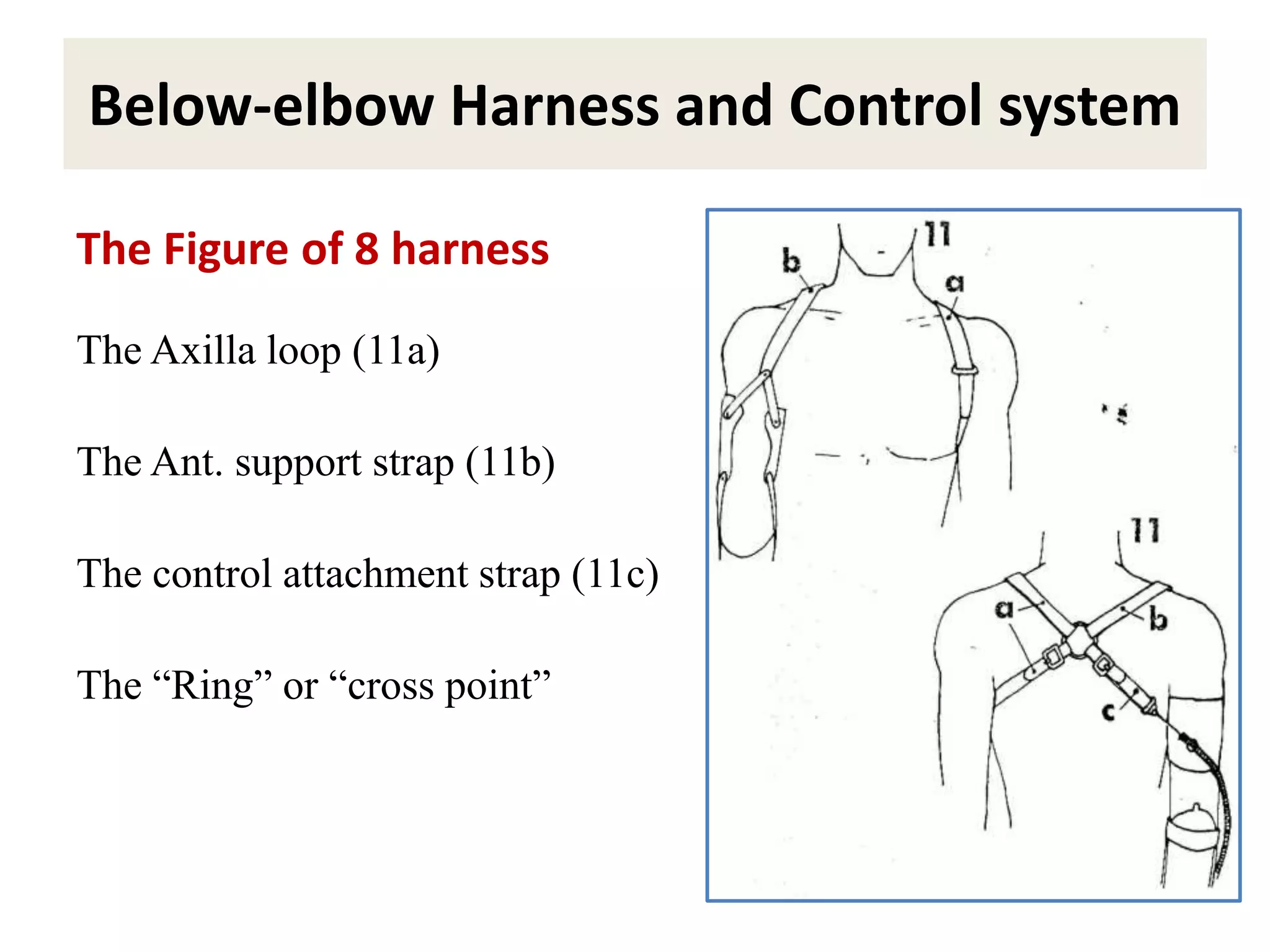 Control and harness sysrem for be and ae prosthetic management | PPTX
