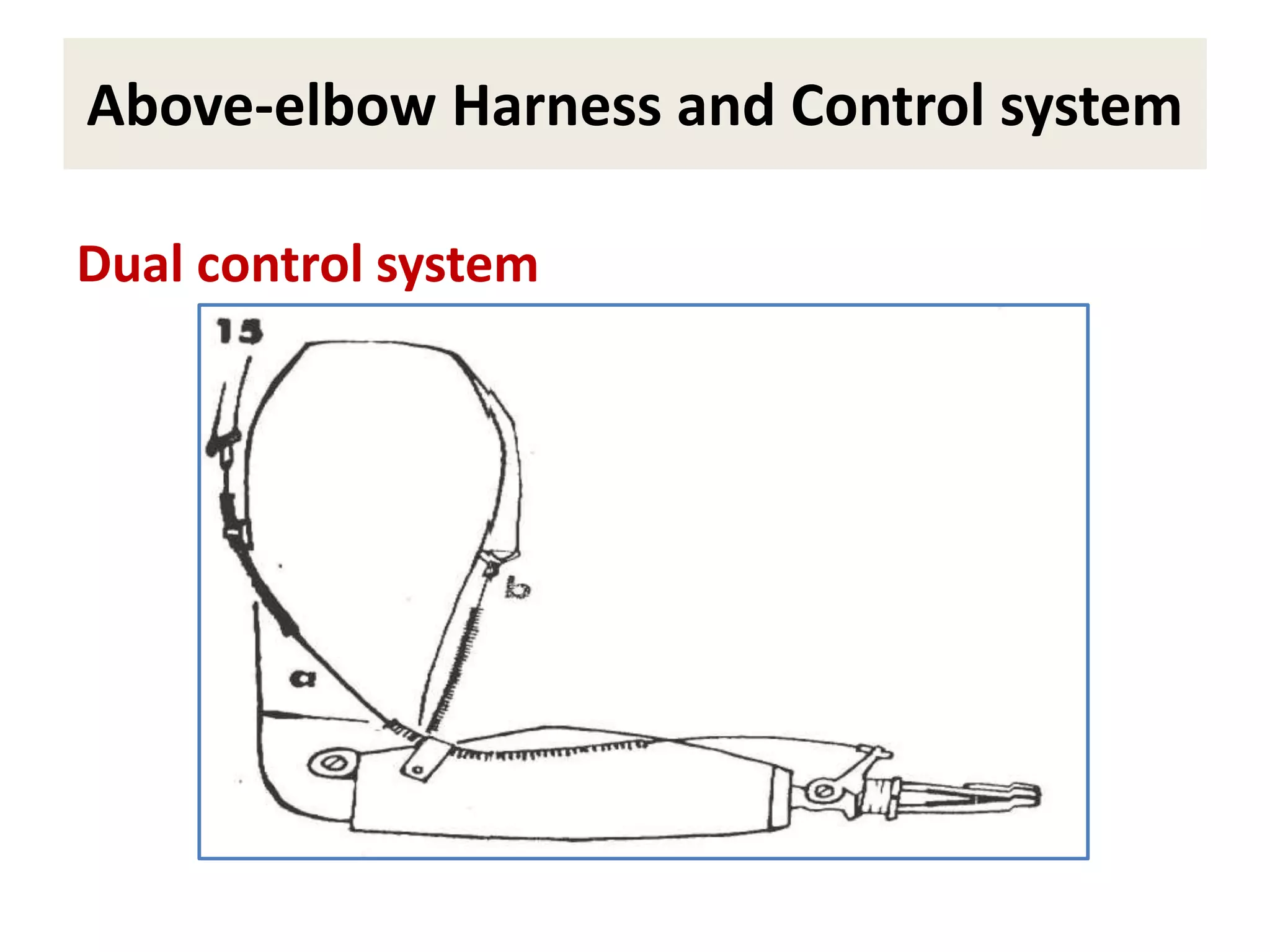 Control and harness sysrem for be and ae prosthetic management | PPTX