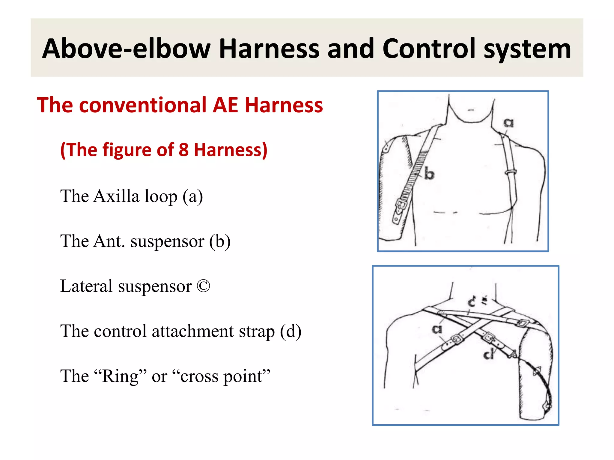 Control and harness sysrem for be and ae prosthetic management | PPTX