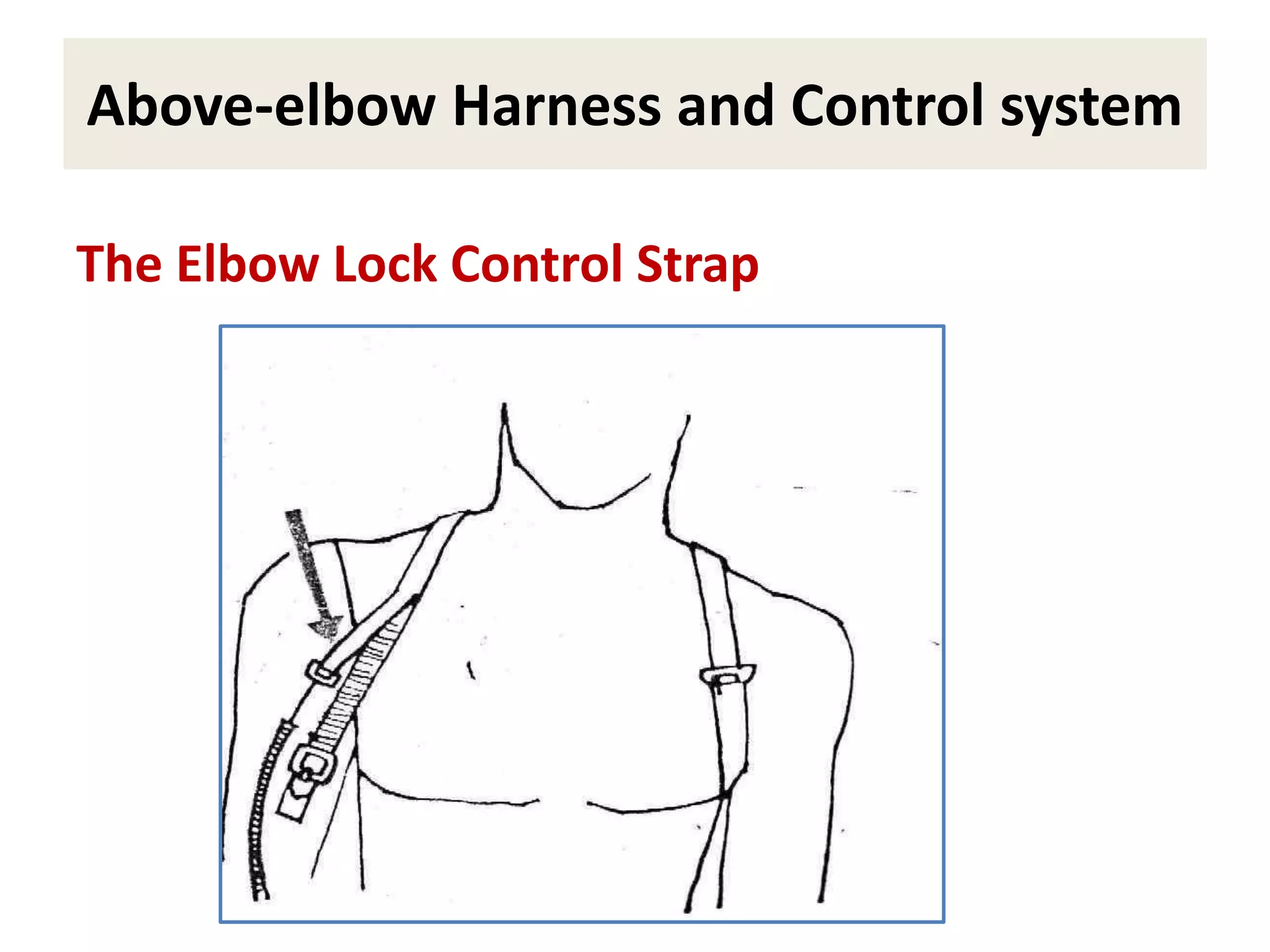 Control and harness sysrem for be and ae prosthetic management | PPTX
