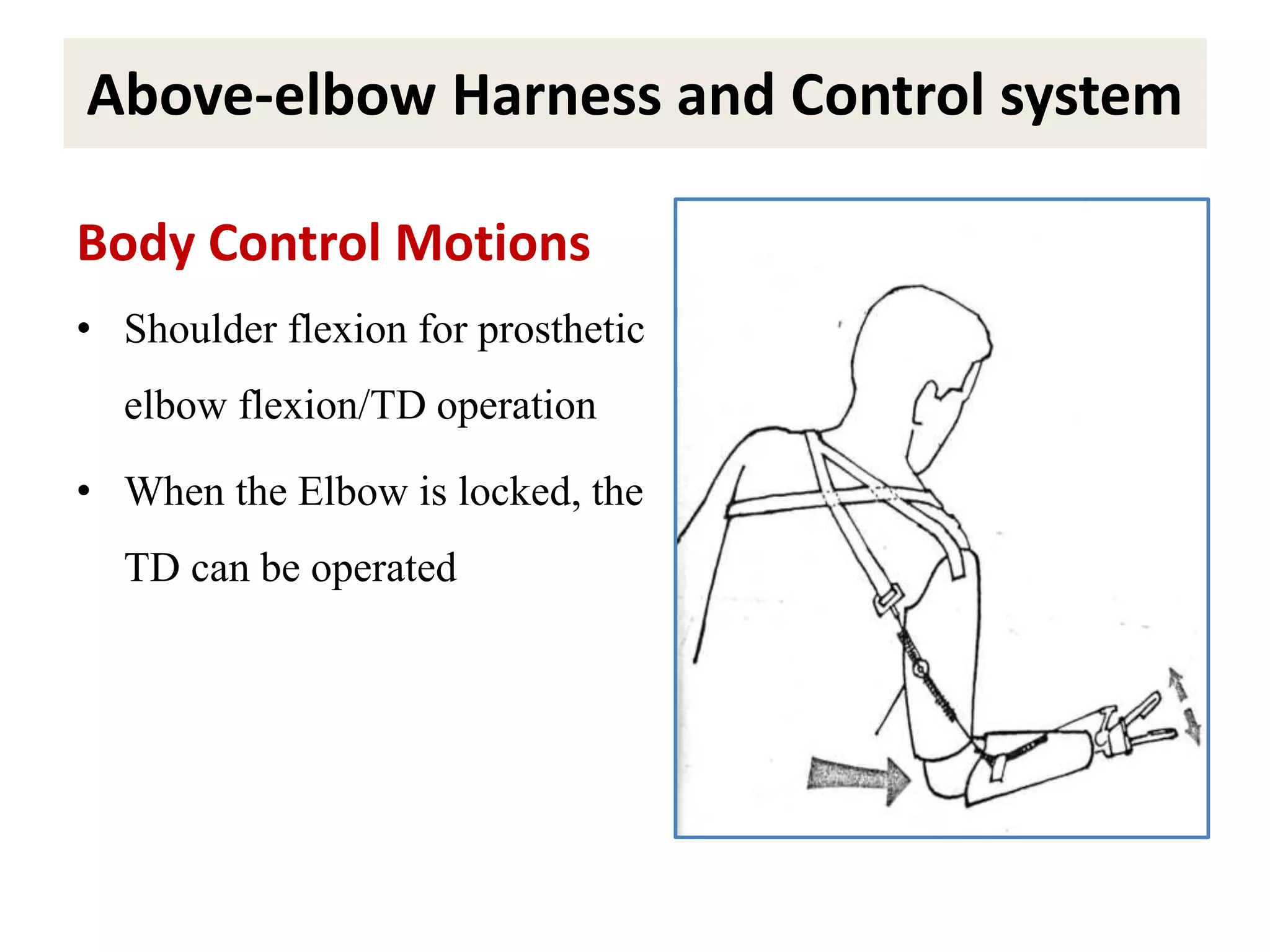 Control and harness sysrem for be and ae prosthetic management | PPTX