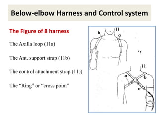 Control and harness sysrem for be and ae prosthetic management | PPTX