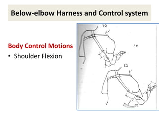 Control and harness sysrem for be and ae prosthetic management | PPTX