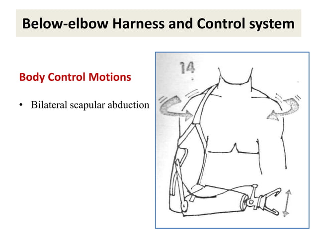 Control and harness sysrem for be and ae prosthetic management | PPTX ...
