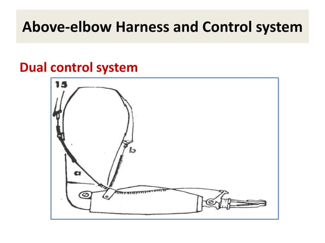 Control and harness sysrem for be and ae prosthetic management | PPTX ...