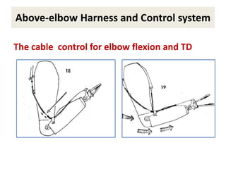 Control and harness sysrem for be and ae prosthetic management | PPTX