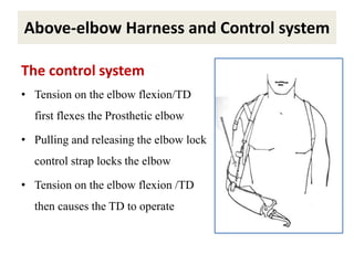 Control and harness sysrem for be and ae prosthetic management | PPTX