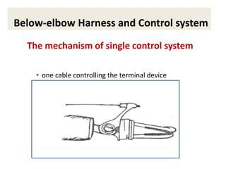 Control and harness sysrem for be and ae prosthetic management | PPTX