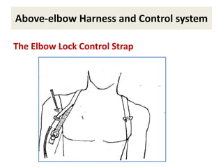 Control and harness sysrem for be and ae prosthetic management | PPTX
