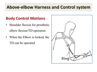 Control and harness sysrem for be and ae prosthetic management | PPTX