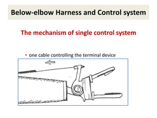 Control and harness sysrem for be and ae prosthetic management | PPTX