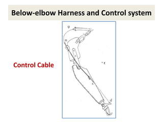 Control and harness sysrem for be and ae prosthetic management | PPTX