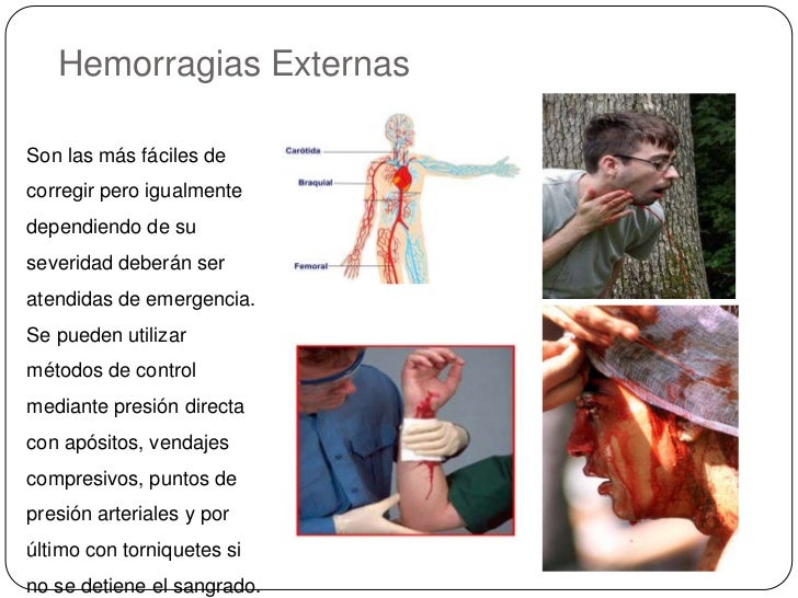 Control de hemorragias